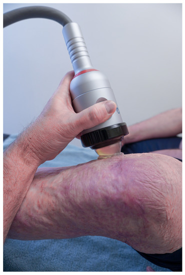 Mechanomodulation: Physical Treatment Modalities Employ ...