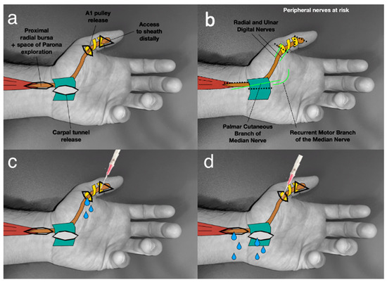 Emergency Care and Medicine | Free Full-Text | Irrigation and ...