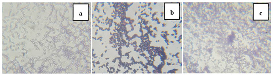 Effective Microorganism (EM) Technology for Lake Conservation and Water ...