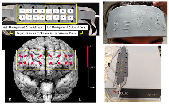 Muscular and Prefrontal Cortex Activity during Dual-Task Performing in ...
