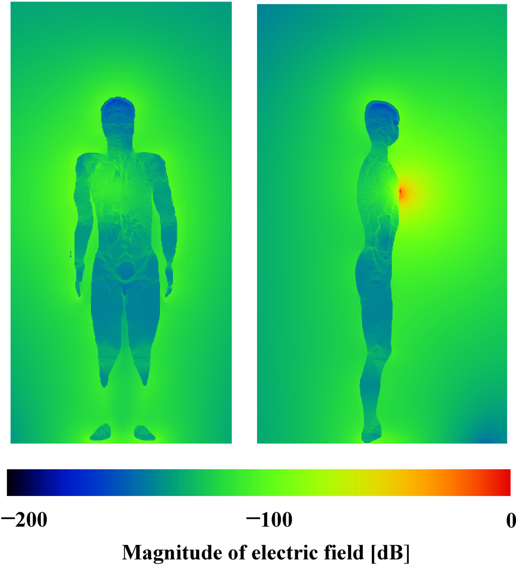 A Compact Dual-Mode Wearable Antenna for Body-Centric Wireless ...
