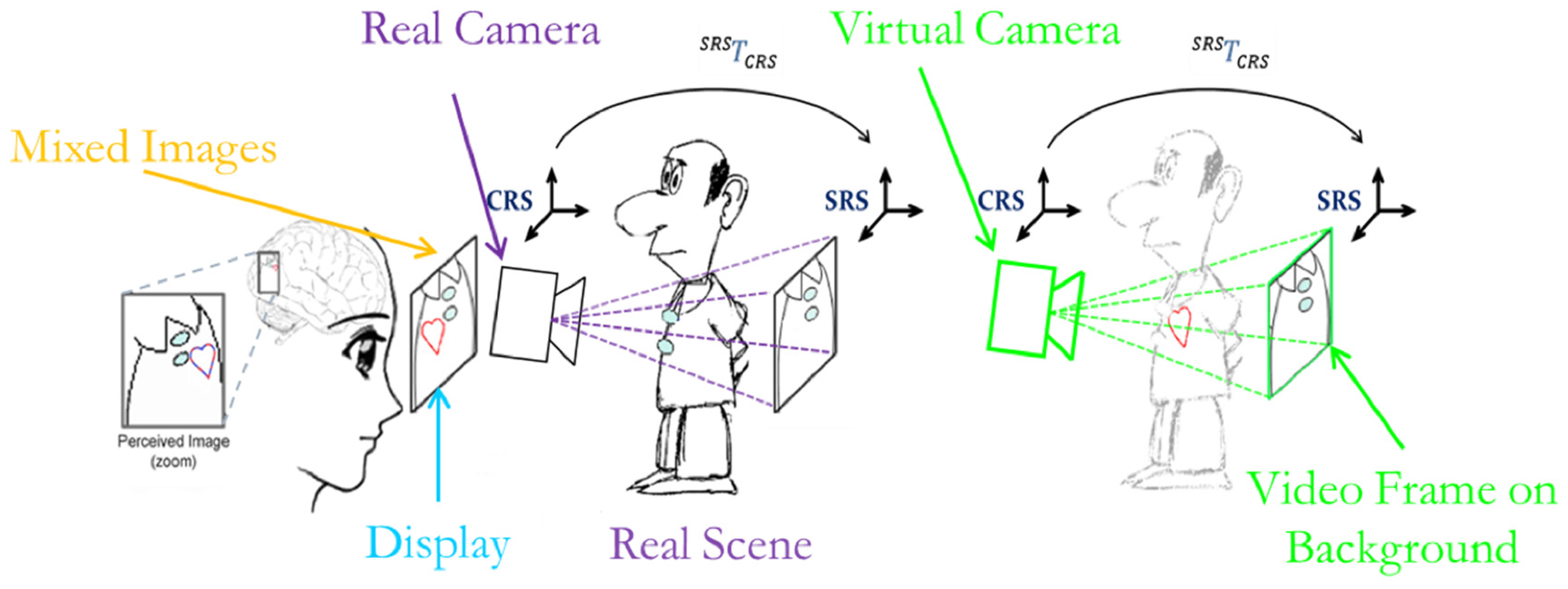 Electronics | Free Full-Text | Robust and Accurate Algorithm for ...