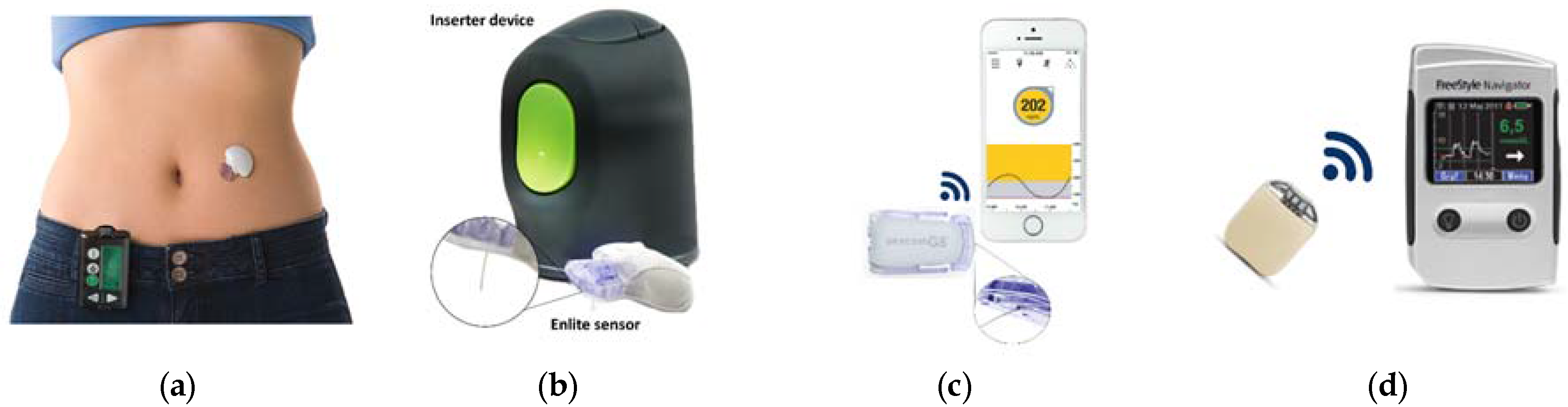 Implantable Continuous Blood Glucose Monitor Implantable Continuous Blood Glucose Monitor