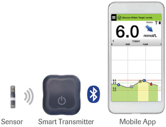 Electronics | Free Full-Text | Wearable Continuous Glucose Monitoring ...
