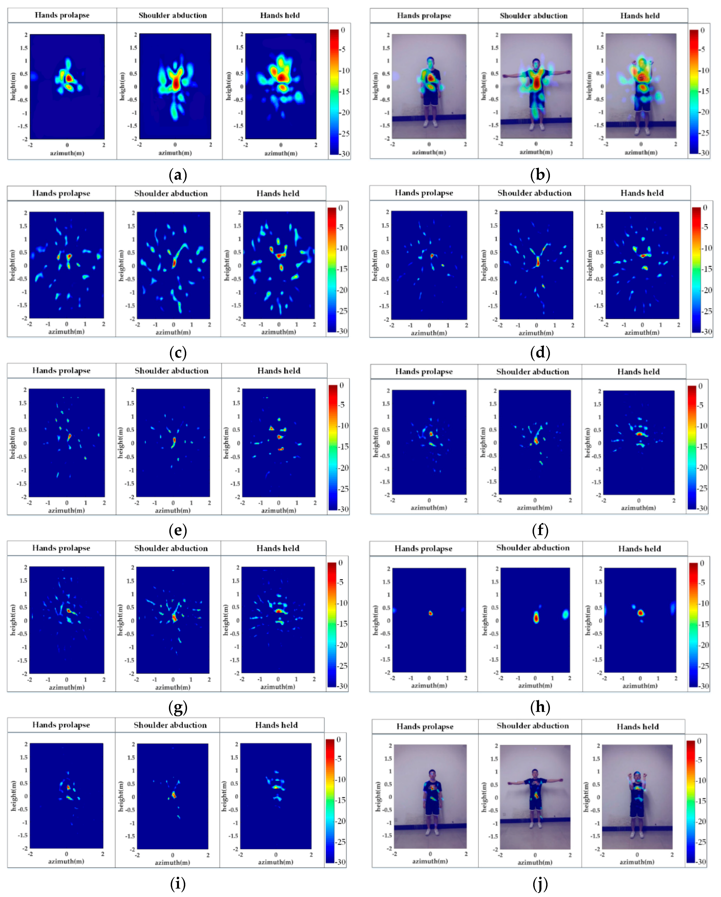 A Three-Dimensional Enhanced Imaging Method on Human Body for Ultra-Wideband Multiple-Input ...