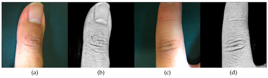 Illumination-Insensitive Skin Depth Estimation from a Light-Field ...