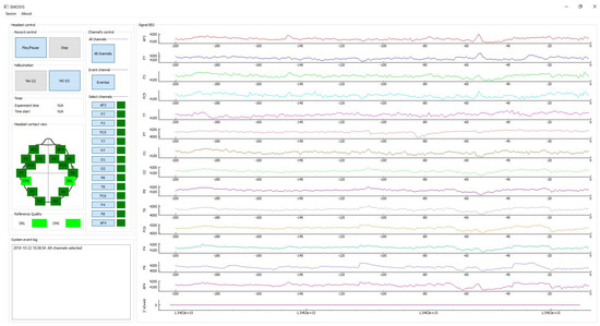 Artificial Neural Networks to Assess Emotional States from Brain ...