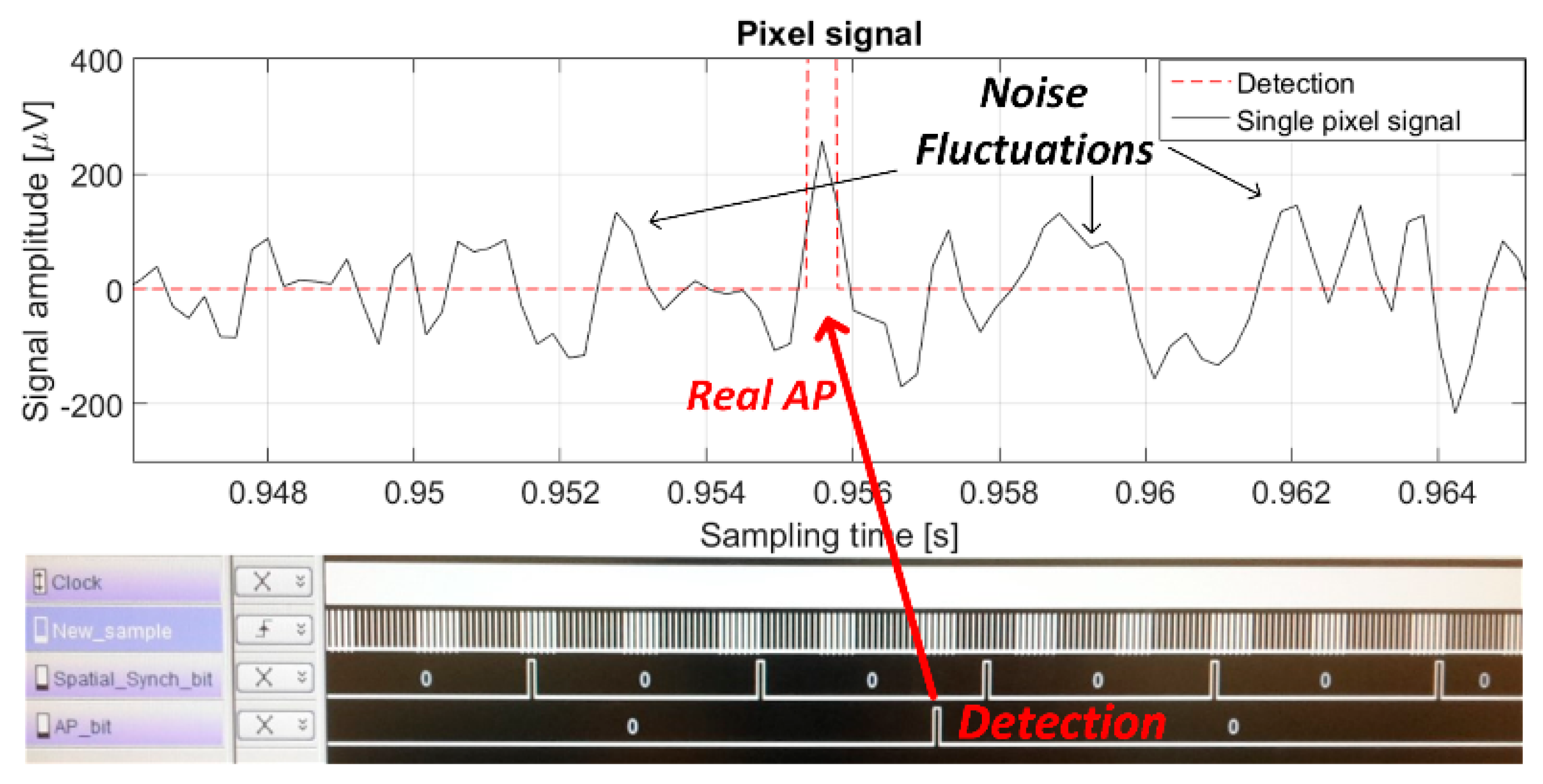 Neural Spike Digital Detector on FPGA
