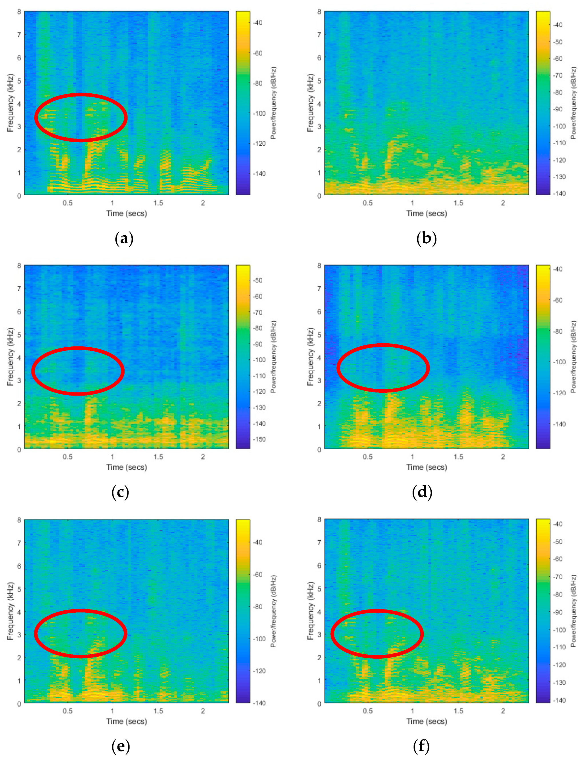 Supervised Single Channel Speech Enhancement Based on Dual-Tree Complex Wavelet Transforms and ...