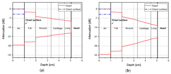 915-MHz Continuous-Wave Doppler Radar Sensor for Detection of Vital Signs