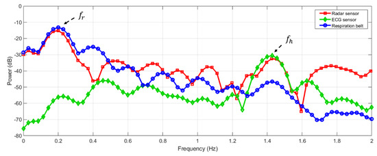 915-MHz Continuous-Wave Doppler Radar Sensor for Detection of Vital Signs