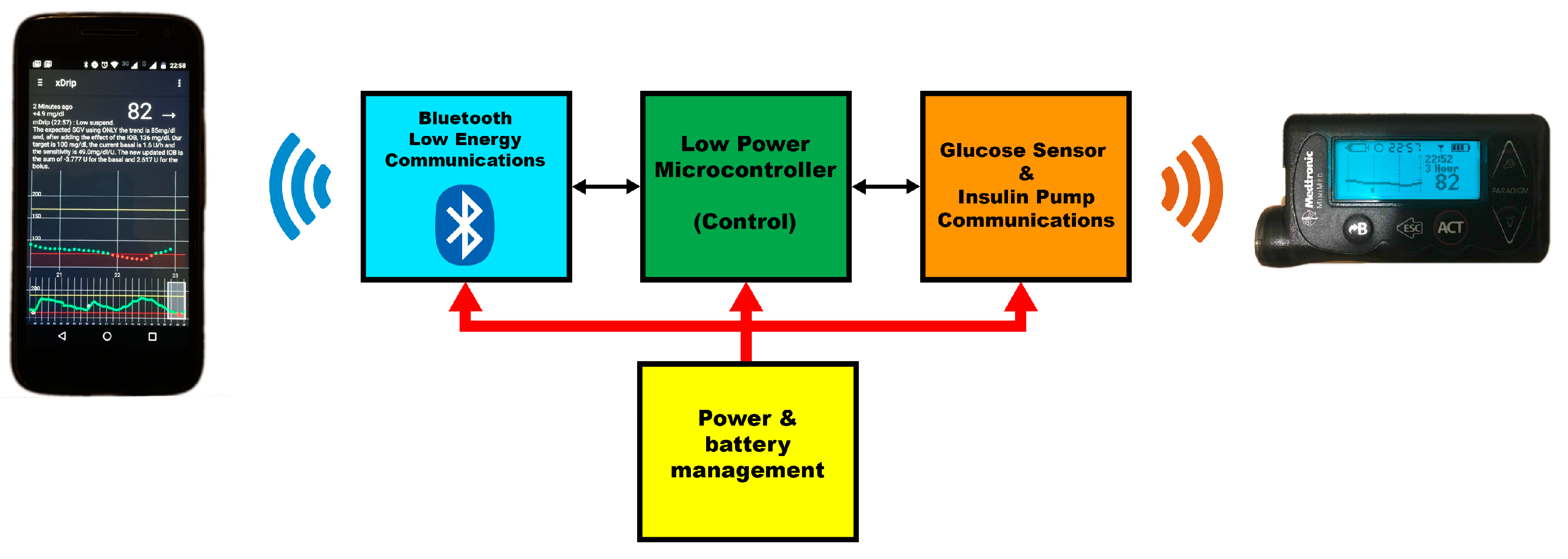Electronics | Free Full-Text | A Wearable Closed-Loop Insulin Delivery ...