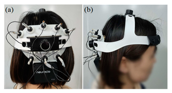 A Dry Electrode Cap and Its Application in a Steady-State Visual Evoked ...
