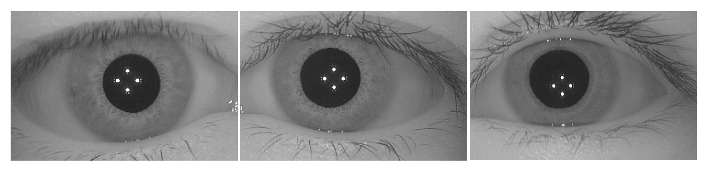 Electronics | Free Full-Text | Classification of Genetically Identical Left and Right Irises ...