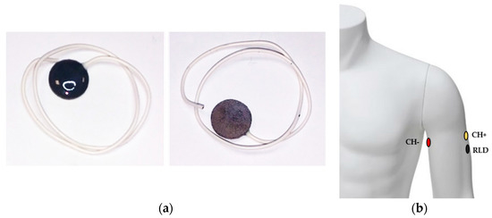 Arm-ECG Wireless Sensor System for Wearable Long-Term Surveillance of ...