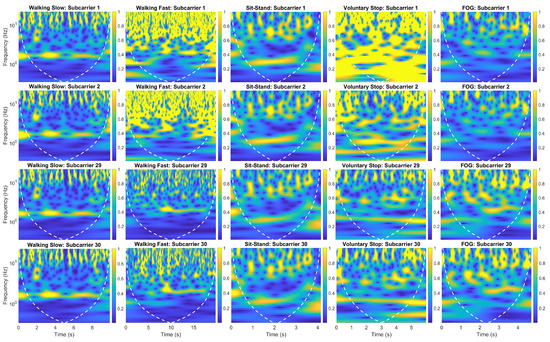 WiFreeze: Multiresolution Scalograms for Freezing of Gait Detection in Parkinson’s Leveraging 5G ...