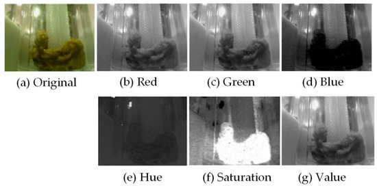 StoolNet for Color Classification of Stool Medical Images