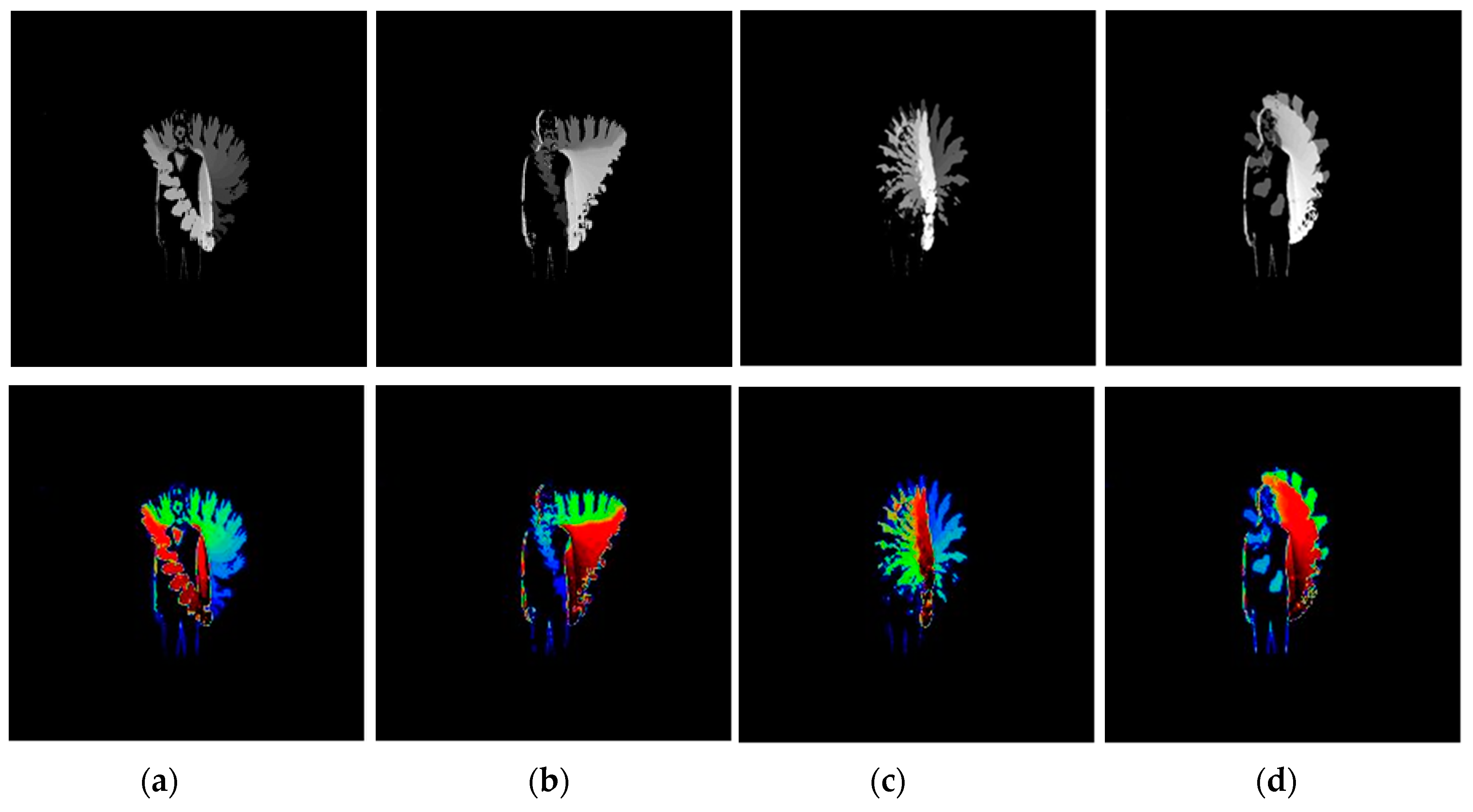 Electronics | Free Full-Text | Fusion of 2D CNN and 3D DenseNet for ...