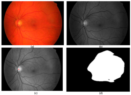 Accelerating Retinal Fundus Image Classification Using Artificial ...