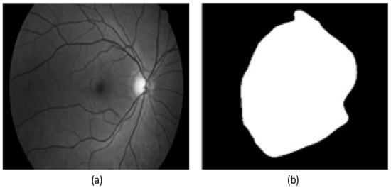 Accelerating Retinal Fundus Image Classification Using Artificial ...