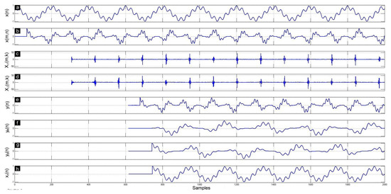 Electronics | Free Full-Text | Efficient FPGA-Based Architecture of the Overlap-Add Method for ...