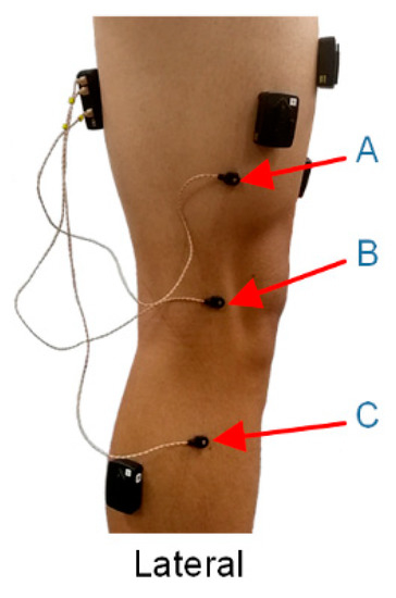 Estimation of Knee Movement from Surface EMG Using Random Forest with ...