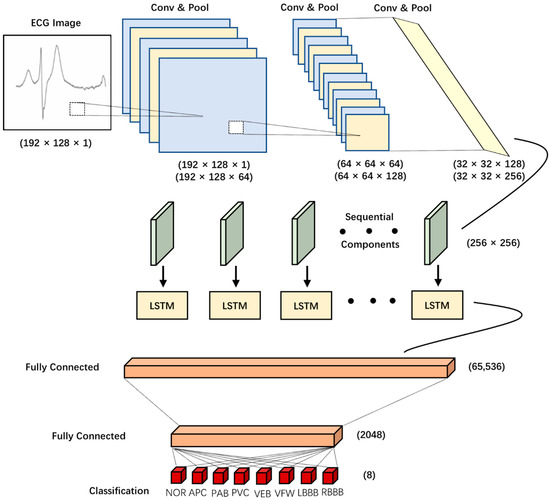 An Automatic Diagnosis of Arrhythmias Using a Combination of CNN and LSTM Technology