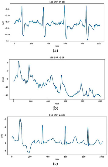 Deep Learning-Based Stacked Denoising and Autoencoder for ECG Heartbeat Classification