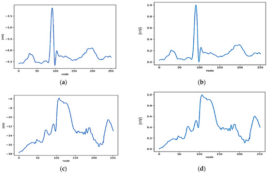 Deep Learning-Based Stacked Denoising and Autoencoder for ECG Heartbeat ...