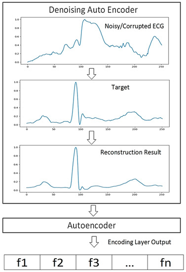 Deep Learning-Based Stacked Denoising and Autoencoder for ECG Heartbeat Classification