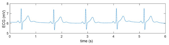 A Multi-Channel Electromyography, Electrocardiography and Inertial ...
