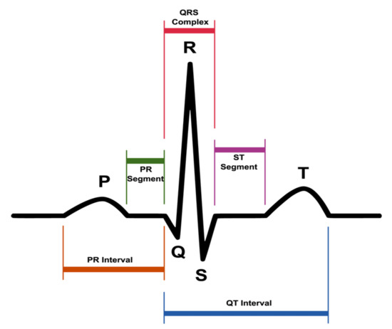 Electronics | Free Full-Text | Automatic ECG Diagnosis Using ...