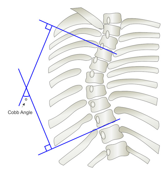 Mobile Applications for Assessing Human Posture: A Systematic ...