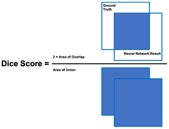 Deep Learning with Limited Data: Organ Segmentation Performance by U-Net