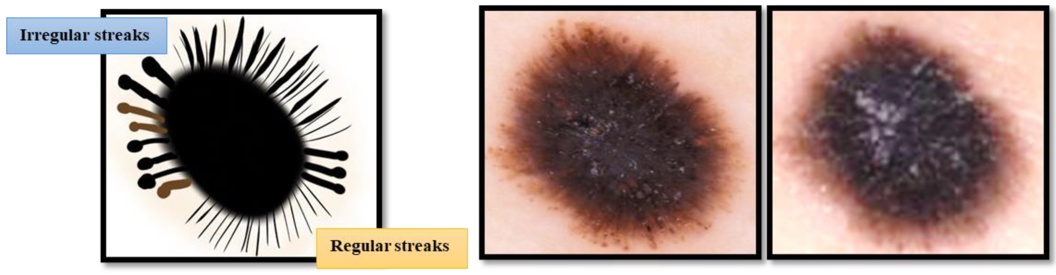 Staging Melanocytic Skin Neoplasms Using High-Level Pixel-Based Features