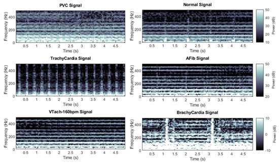 Electronics | Free Full-Text | The Use of Time-Frequency Moments as ...