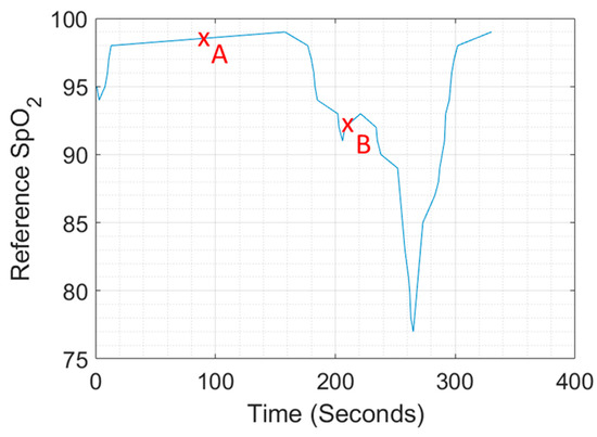 Development of a Wearable Reflection-Type Pulse Oximeter System to ...