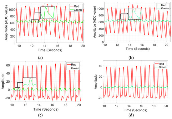 Development of a Wearable Reflection-Type Pulse Oximeter System to ...