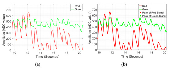 Development of a Wearable Reflection-Type Pulse Oximeter System to ...