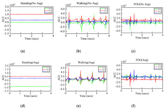 Improved Deep Learning Technique to Detect Freezing of Gait in ...