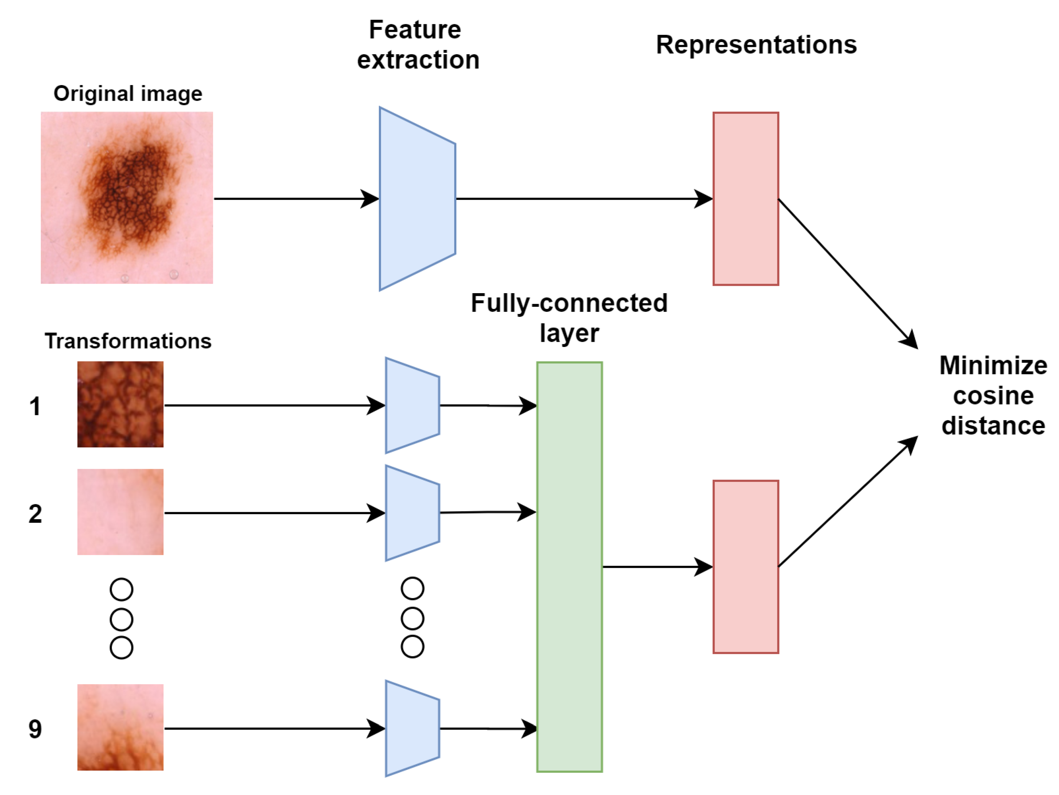 Self-Supervised Learning to Increase the Performance of Skin Lesion Classification