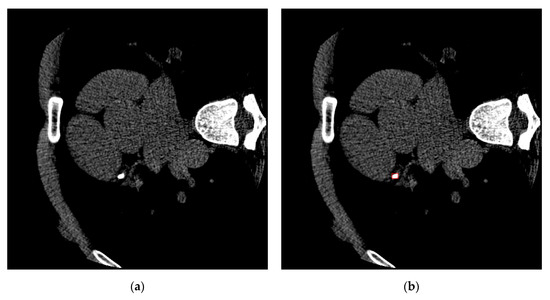 Medical Prior Knowledge Guided Automatic Detection of Coronary Arteries ...