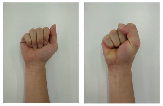 Electronics | Free Full-Text | Robustness of Rhythmic-Based Dynamic ...