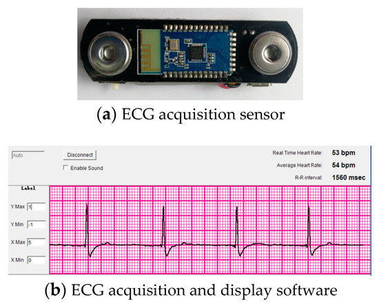 Electronics | Free Full-Text | Research of HRV as a Measure of Mental ...