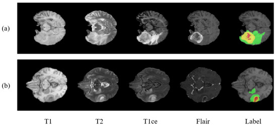 BU-Net: Brain Tumor Segmentation Using Modified U-Net Architecture