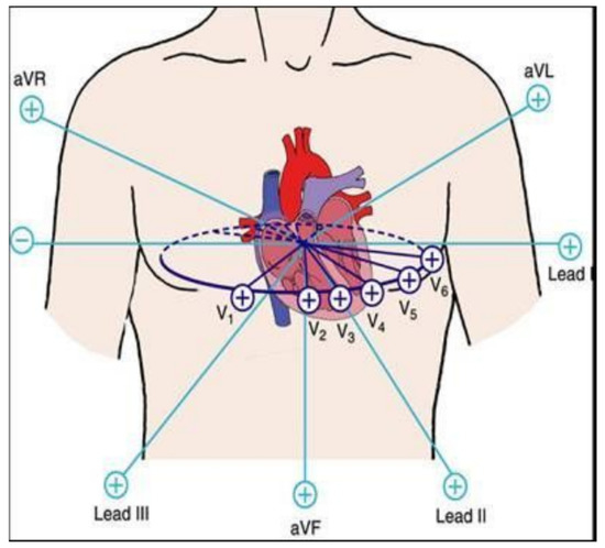 Electronics | Free Full-Text | Multiclass ECG Signal Analysis Using Global Average-Based 2-D ...