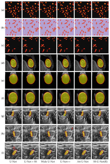 A Self-Spatial Adaptive Weighting Based U-Net for Image Segmentation