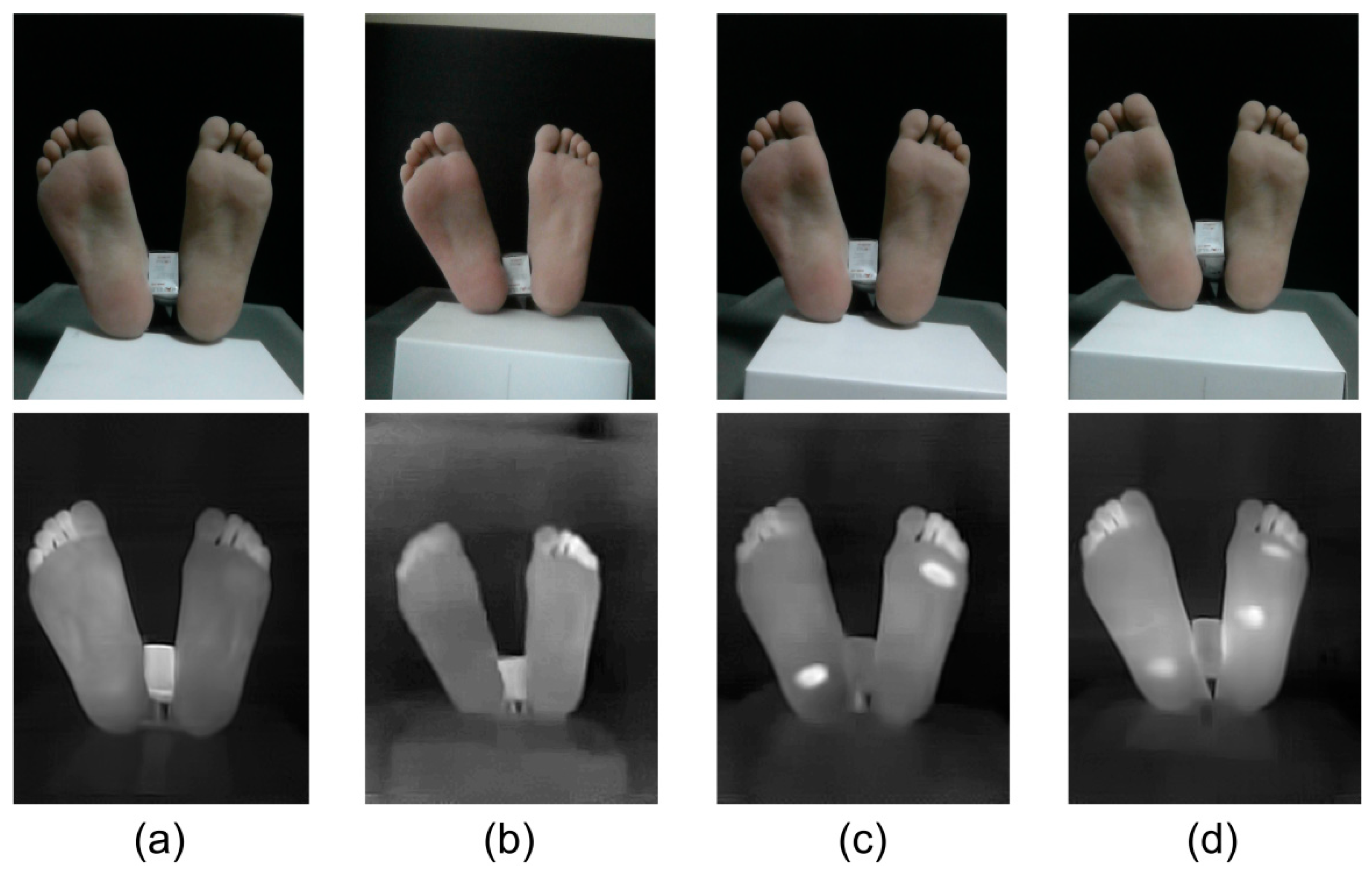 Algorithm for Automated Foot Detection in Thermal and Optical Images for Temperature Asymmetry ...