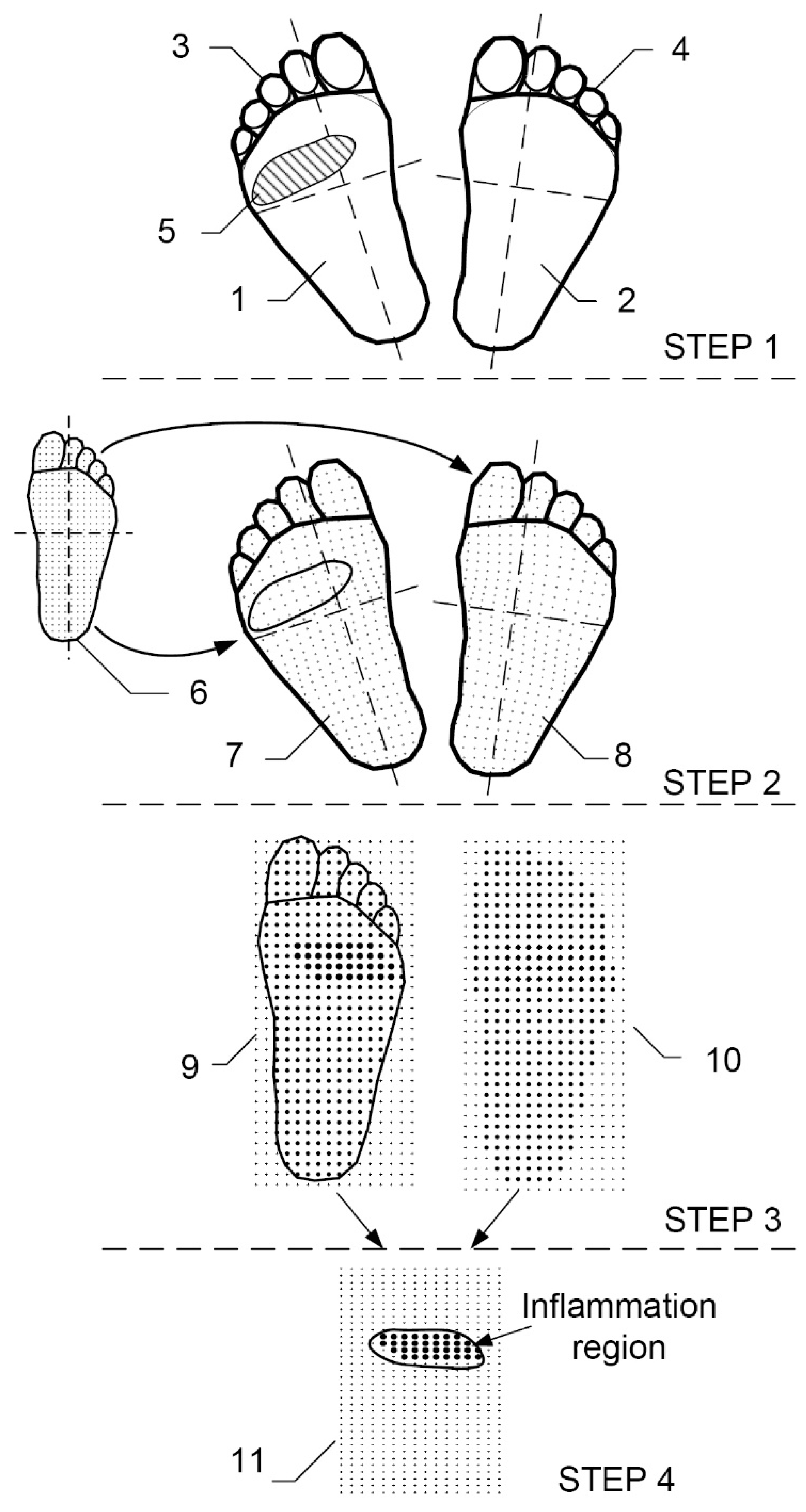 Algorithm for Automated Foot Detection in Thermal and Optical Images for Temperature Asymmetry ...
