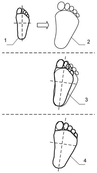 Algorithm for Automated Foot Detection in Thermal and Optical Images ...